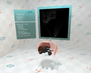 Feature - Imaging Ultrasound - EN - InfinyTech3D