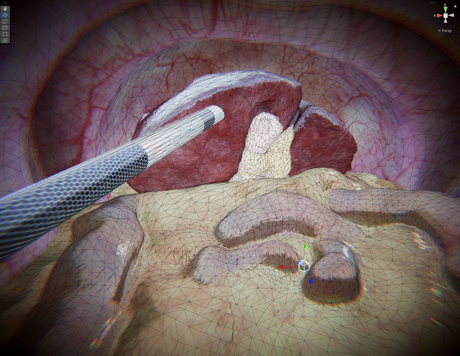 SofaUnity - DLC – 3D Liver Models - InfinyTech3D