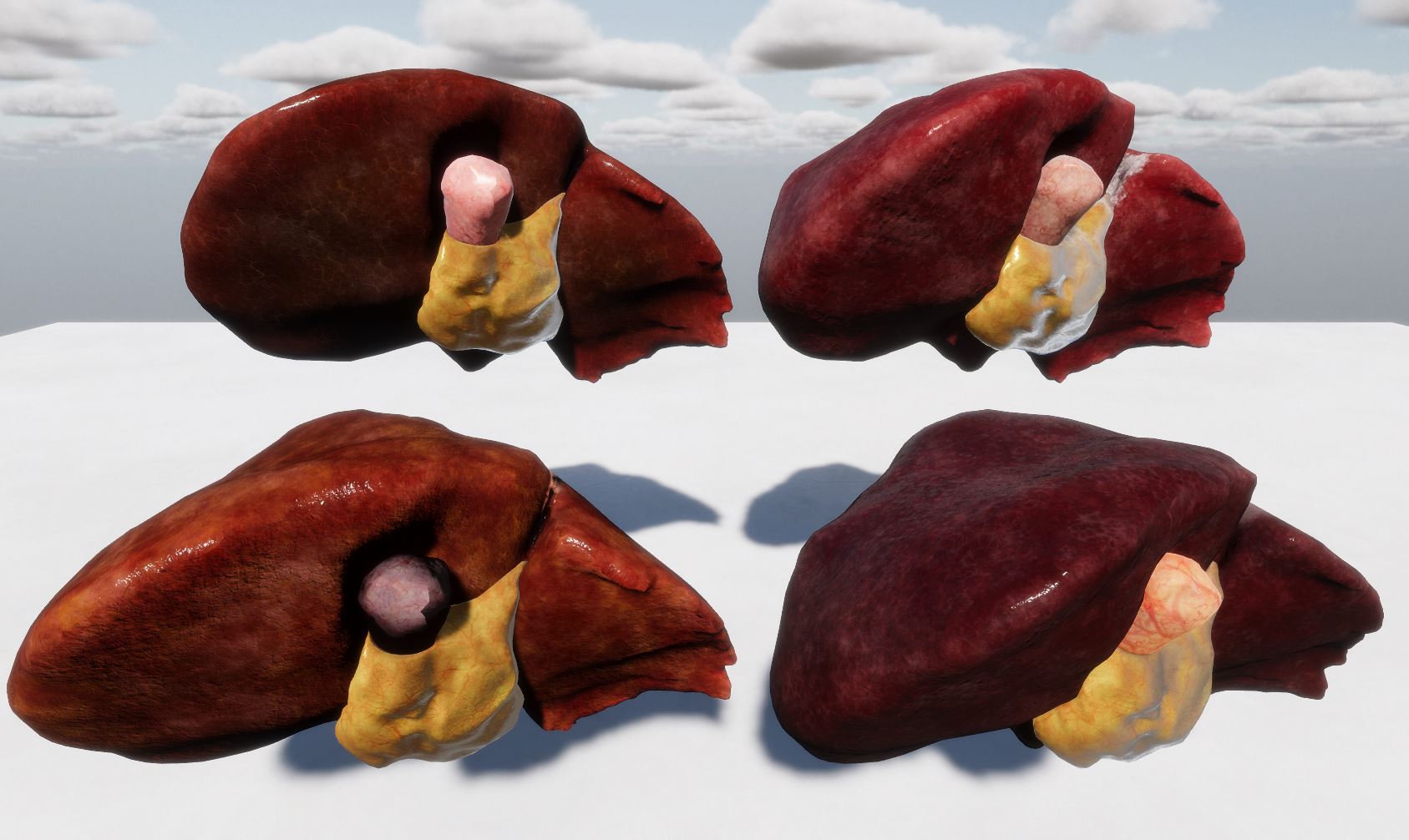 SofaUnity - DLC – 3D Liver Models - InfinyTech3D